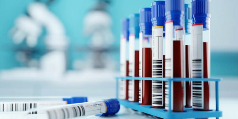 Qué es GGT en un análisis de sangre - Blog SaludOnNet